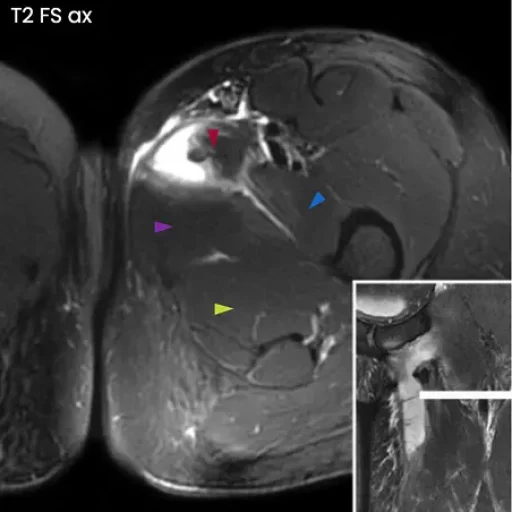 MRI Essentials: The ultimate MRI reference and teaching app