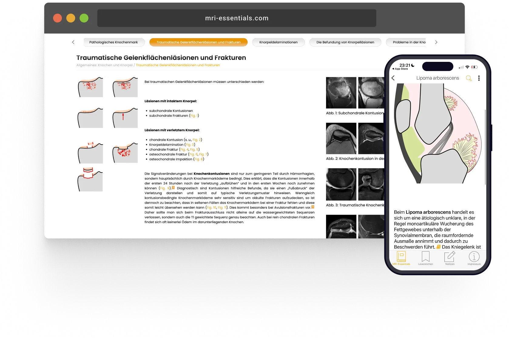 MRI Essentials: The ultimate MRI reference and teaching app